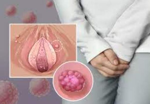 小菜花是什么病_小菜花初期症状图片-第2张图片-山城妙识