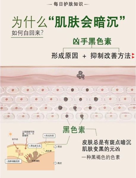 色素沉淀怎么消除_皮肤色素沉淀怎么淡化-第1张图片-山城妙识