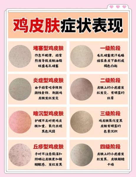 鸡皮肤图片手臂_怎么消除-第2张图片-山城妙识 鸡皮肤图片手臂_怎么消除-第2张图片-山城妙识