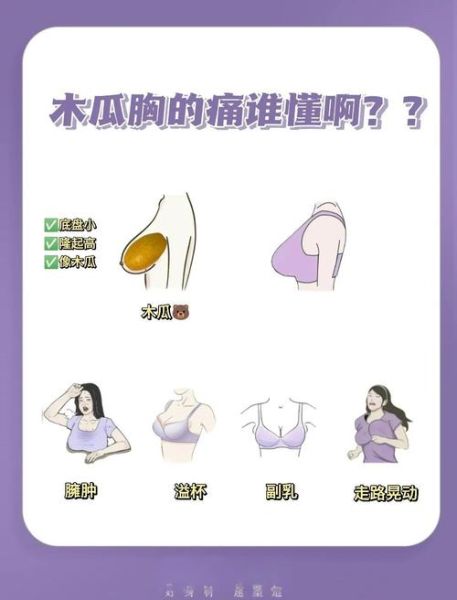 木瓜胸是什么样子_木瓜胸长什么样-第1张图片-山城妙识
