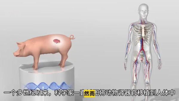 猪肾移植人体最新进展_猪肾移植人体能活多久-第2张图片-山城妙识