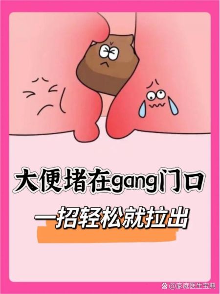 屎太硬已到肛门拉不出怎么办_如何快速软化-第1张图片-山城妙识