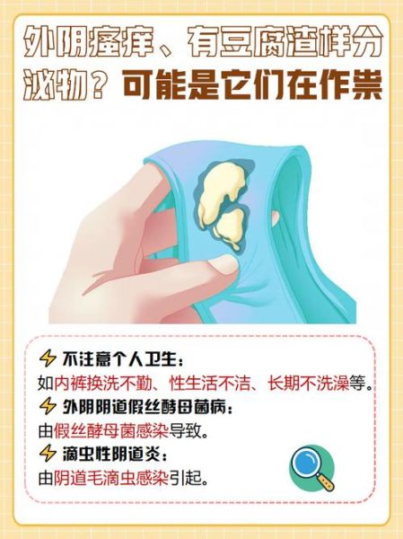 豆腐渣样白带图片_豆腐渣样白带是什么炎症-第3张图片-山城妙识