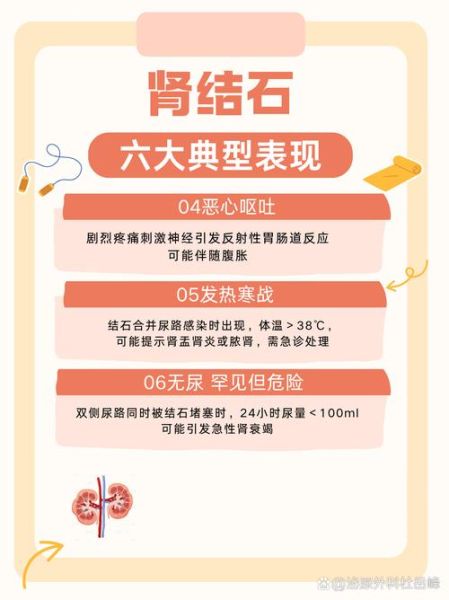 肾结石的早期症状_如何判断自己有肾结石-第1张图片-山城妙识