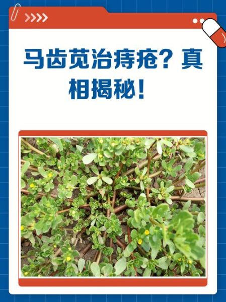 马齿苋治痔疮的方法_马齿苋治痔疮有效吗-第3张图片-山城妙识