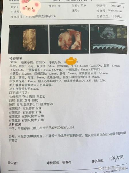 大排畸检查多少钱_大排畸价格是多少-第1张图片-山城妙识