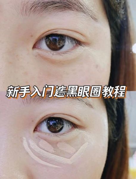 怎么消除黑眼圈最有效_黑眼圈怎么快速消除-第3张图片-山城妙识 怎么消除黑眼圈最有效_黑眼圈怎么快速消除-第3张图片-山城妙识