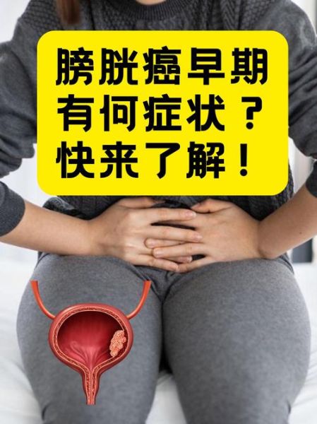 体内有癌的早期症状_如何判断体内有癌-第2张图片-山城妙识 体内有癌的早期症状_如何判断体内有癌-第2张图片-山城妙识