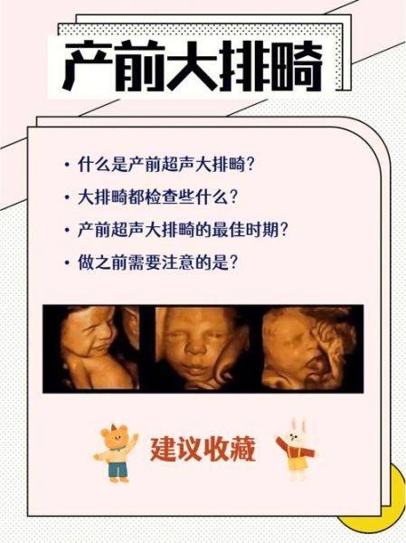 大排畸什么时候做最好_最佳孕周是多少-第1张图片-山城妙识