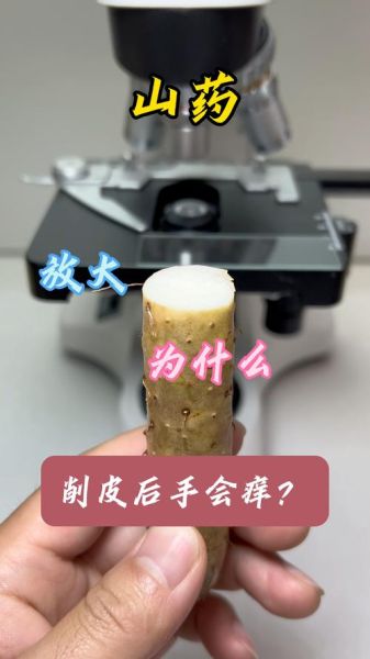 切淮山手痒怎么办_淮山痒手快速止痒方法-第2张图片-山城妙识 切淮山手痒怎么办_淮山痒手快速止痒方法-第2张图片-山城妙识