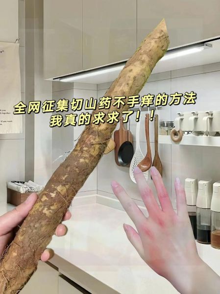 切淮山手痒怎么办_淮山痒手快速止痒方法-第1张图片-山城妙识 切淮山手痒怎么办_淮山痒手快速止痒方法-第1张图片-山城妙识