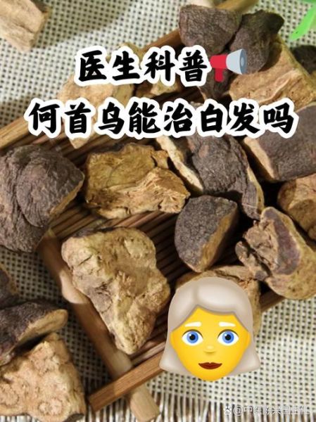 何首乌可以治疗脱发吗_何首乌治疗脱发效果怎么样-第1张图片-山城妙识