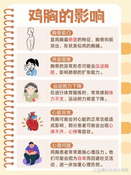 青少年鸡胸图片_鸡胸怎么矫正-第2张图片-山城妙识 青少年鸡胸图片_鸡胸怎么矫正-第2张图片-山城妙识