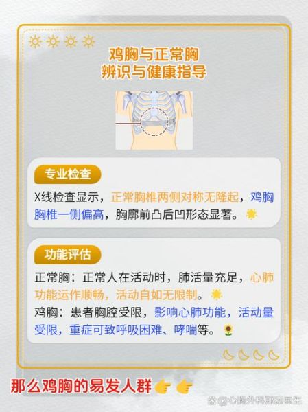 青少年鸡胸图片_鸡胸怎么矫正-第3张图片-山城妙识 青少年鸡胸图片_鸡胸怎么矫正-第3张图片-山城妙识