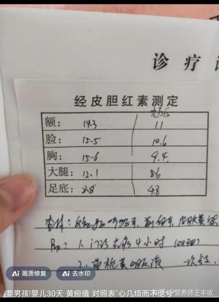 橘子吃多了皮肤会变黄吗_胡萝卜素血症多久能退-第3张图片-山城妙识 橘子吃多了皮肤会变黄吗_胡萝卜素血症多久能退-第3张图片-山城妙识