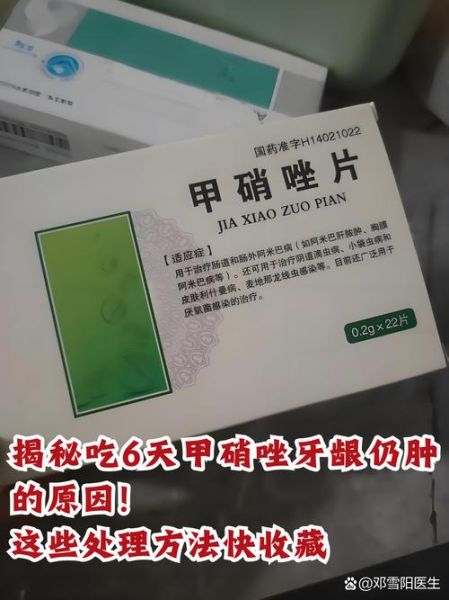 牙龈肿痛吃什么消炎药_牙龈肿痛消炎药怎么选-第1张图片-山城妙识