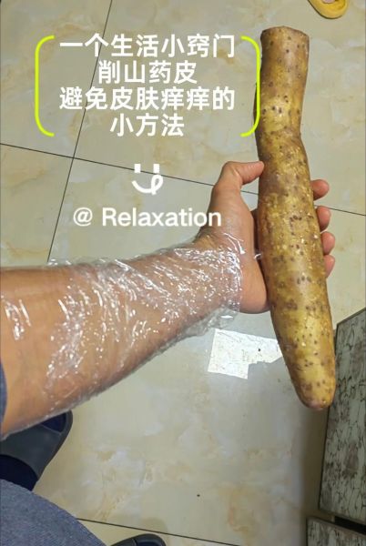 切山药手痒怎么办_快速止痒小妙招-第2张图片-山城妙识