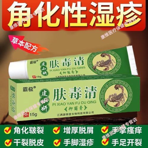 皮肤过敏怎么办_皮肤过敏用什么药膏-第2张图片-山城妙识