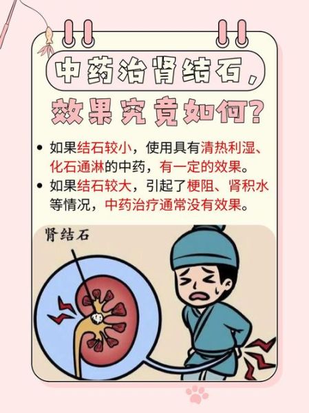 小苏打治疗肾结石_肾结石自然疗法-第1张图片-山城妙识 小苏打治疗肾结石_肾结石自然疗法-第1张图片-山城妙识