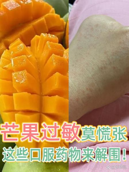 芒果过敏怎么办_芒果过敏症状多久消失-第3张图片-山城妙识