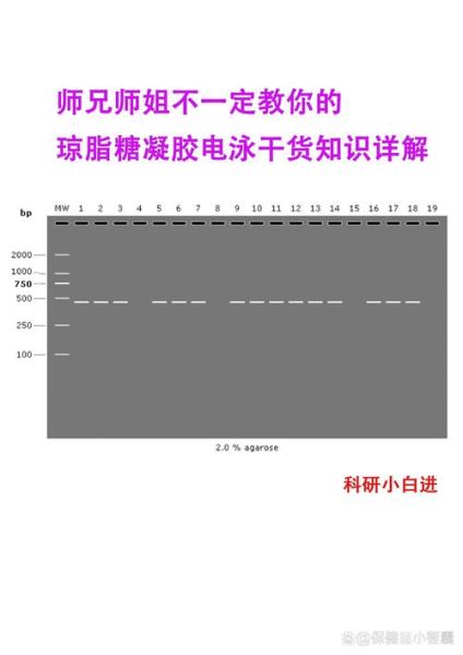 琼脂糖凝胶电泳条带模糊怎么办_琼脂糖凝胶浓度如何选择-第2张图片-山城妙识