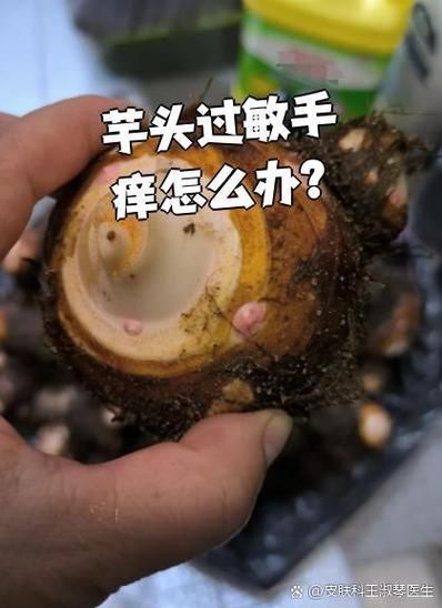 芋头手痒是什么原因_怎么处理最快止痒-第2张图片-山城妙识
