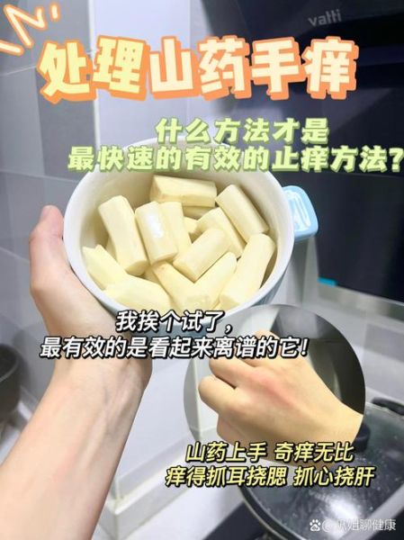 刮山药后手痒怎么办_最有效的止痒方法-第1张图片-山城妙识 刮山药后手痒怎么办_最有效的止痒方法-第1张图片-山城妙识