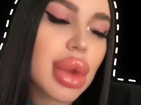 香肠嘴图片女丑_香肠嘴女生怎么改善-第1张图片-山城妙识 香肠嘴图片女丑_香肠嘴女生怎么改善-第1张图片-山城妙识