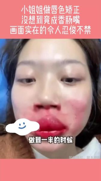 香肠嘴图片女丑_香肠嘴女生怎么改善-第2张图片-山城妙识 香肠嘴图片女丑_香肠嘴女生怎么改善-第2张图片-山城妙识