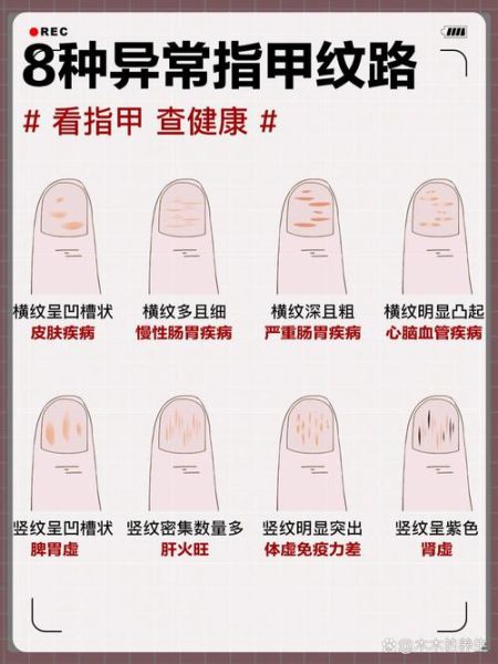 健康状况分为哪四类_如何快速判断自己属于哪一类-第3张图片-山城妙识 健康状况分为哪四类_如何快速判断自己属于哪一类-第3张图片-山城妙识