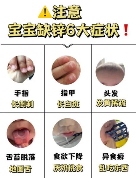 严重缺锌的手指甲图片_指甲有白点是缺锌吗-第2张图片-山城妙识