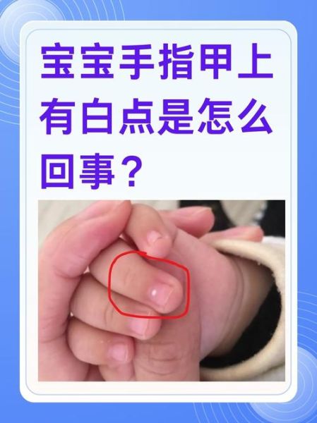 严重缺锌的手指甲图片_指甲有白点是缺锌吗-第1张图片-山城妙识