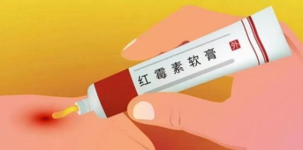 红霉素软膏外阴瘙痒能用吗_外阴瘙痒用什么药-第2张图片-山城妙识