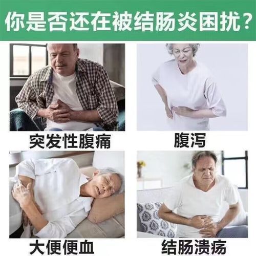 慢性结肠炎吃什么药效果最好_慢性结肠炎吃什么药能根治-第2张图片-山城妙识