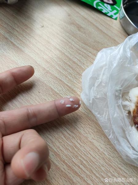 叉烧包事件真相_叉烧包事件影响-第1张图片-山城妙识 叉烧包事件真相_叉烧包事件影响-第1张图片-山城妙识