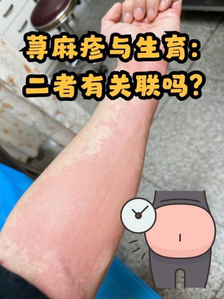 皮肤过敏症状图片_怎么判断是不是过敏-第2张图片-山城妙识 皮肤过敏症状图片_怎么判断是不是过敏-第2张图片-山城妙识