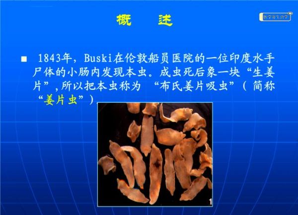 姜片虫寄生在人体的什么部位_感染后有哪些症状-第3张图片-山城妙识