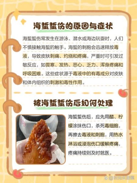 海蜇蜇人后怎么处理_海蜇蜇伤多久能好-第3张图片-山城妙识