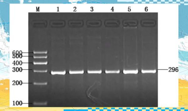 琼脂糖凝胶电泳marker怎么选_marker条带大小怎么看-第1张图片-山城妙识
