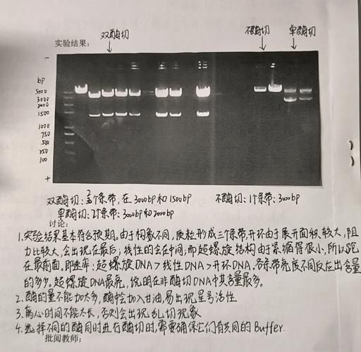 琼脂糖凝胶电泳marker怎么选_marker条带大小怎么看-第2张图片-山城妙识