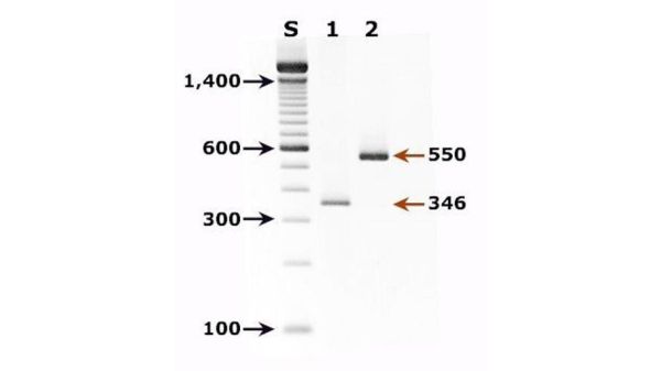 琼脂糖凝胶电泳marker怎么选_marker条带大小怎么看-第3张图片-山城妙识