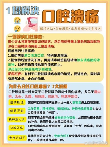 口腔溃疡怎么快速止痛_口腔溃疡止痛小妙招-第1张图片-山城妙识 口腔溃疡怎么快速止痛_口腔溃疡止痛小妙招-第1张图片-山城妙识