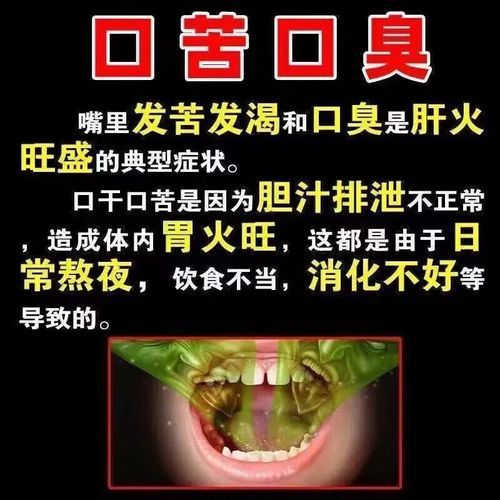 肝火旺的症状怎么调理_肝火旺吃什么食物好-第3张图片-山城妙识