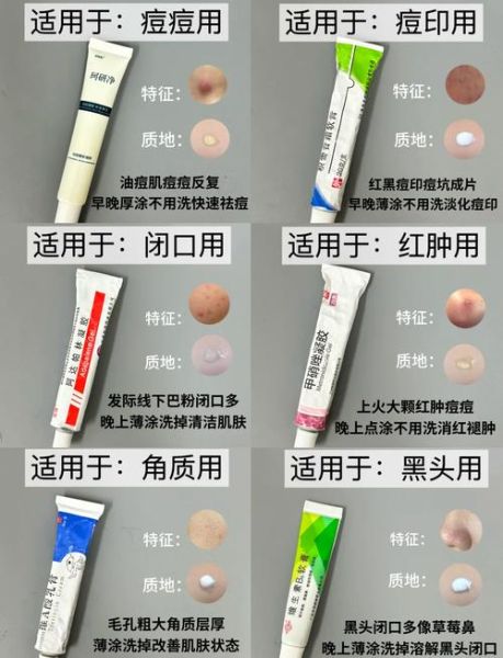 祛痘印最有效的方法_痘痘反复长怎么办-第3张图片-山城妙识