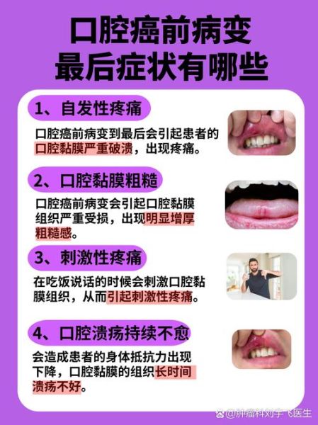 口腔溃疡反复不愈_警惕口腔癌前病变-第1张图片-山城妙识