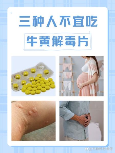 牛黄解毒片还是黄连上清丸好_区别与适用人群-第3张图片-山城妙识 牛黄解毒片还是黄连上清丸好_区别与适用人群-第3张图片-山城妙识