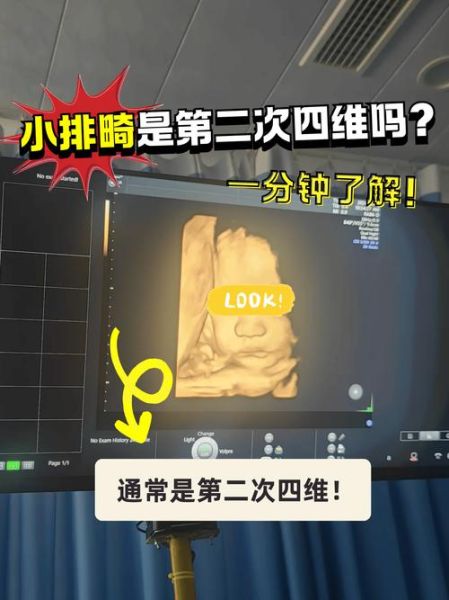 小排畸最佳时间_几周做最合适-第1张图片-山城妙识