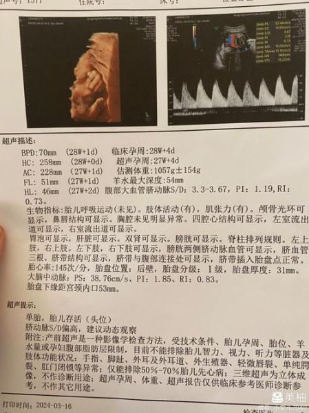 小排畸最佳时间_几周做最合适-第2张图片-山城妙识