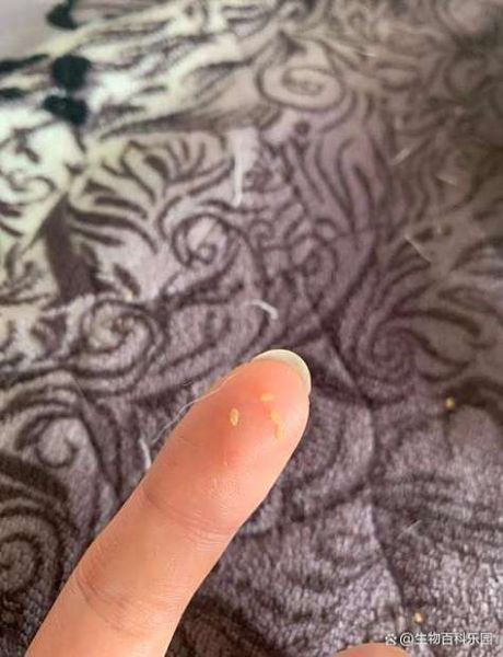 绦虫节片长什么样_绦虫节片会传染人吗-第1张图片-山城妙识