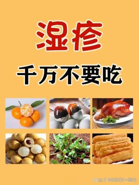 吃海鲜过敏怎么办_最有效处理方法-第1张图片-山城妙识